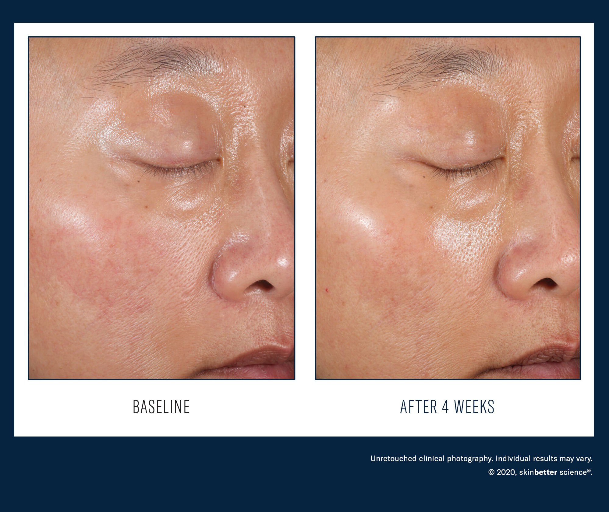 About Us - Our Story & Commitment - SkinBetter Science CA